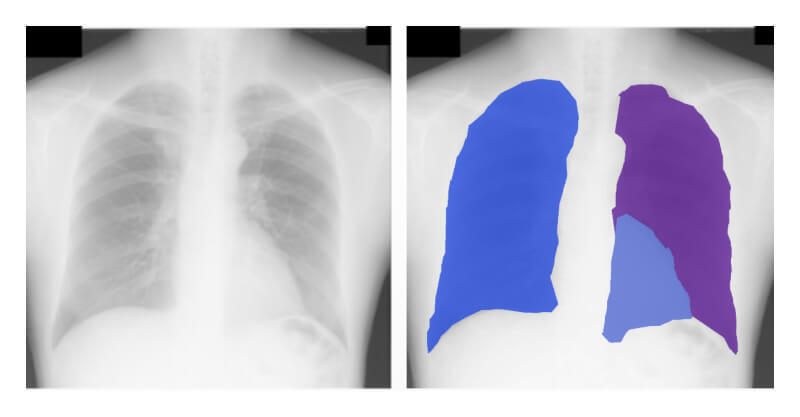 Semantic segmentation: Complete guide [Updated 2024] | SuperAnnotate